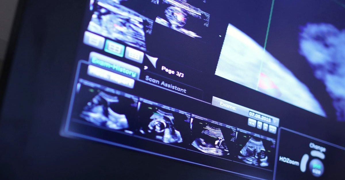 Non-destructive measurements for determining the performance of a CMUT ...